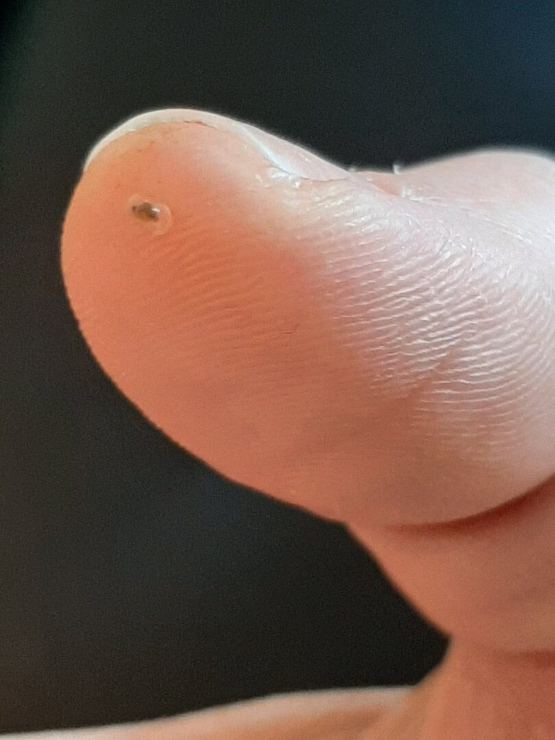Baby snail or limpet? - General Chat - Aquarium Co-Op Forum