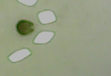 Question on cyclops and seed shrimp in infusoria - Fish Breeding ...