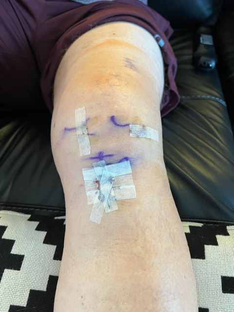 ACL reconstruction - Instruction & Academy - GolfWRX