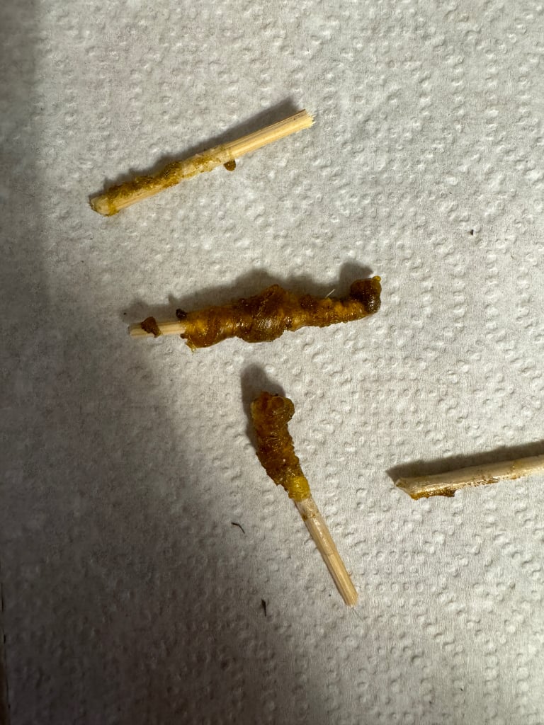 What’s this brown sticky stuff that was in my head?? - WRX Club Techs ...
