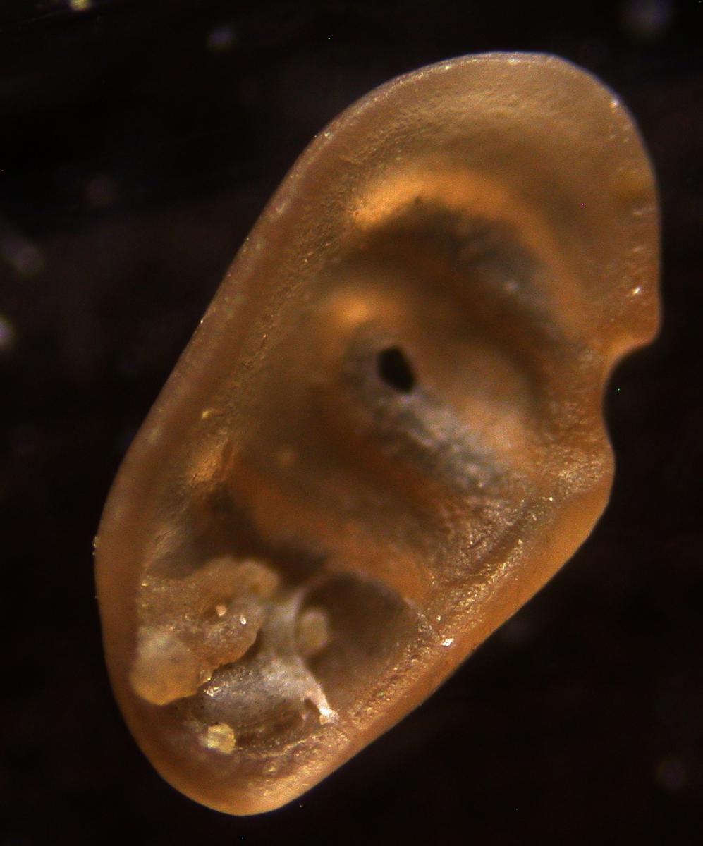 Micro Fossils from Arkona Shale - Member Collections - The Fossil Forum