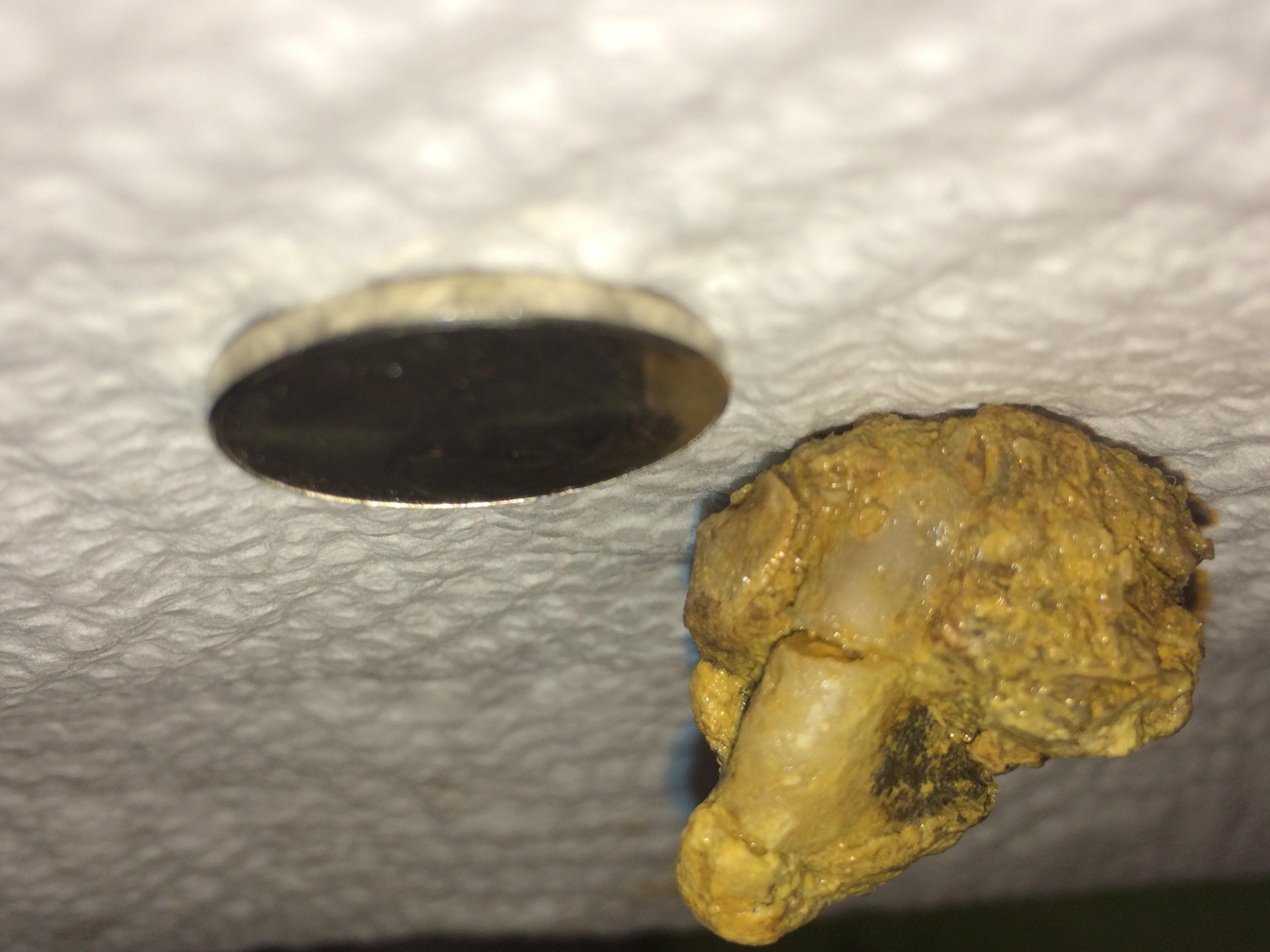 Found digging a pond - Fossil ID - The Fossil Forum