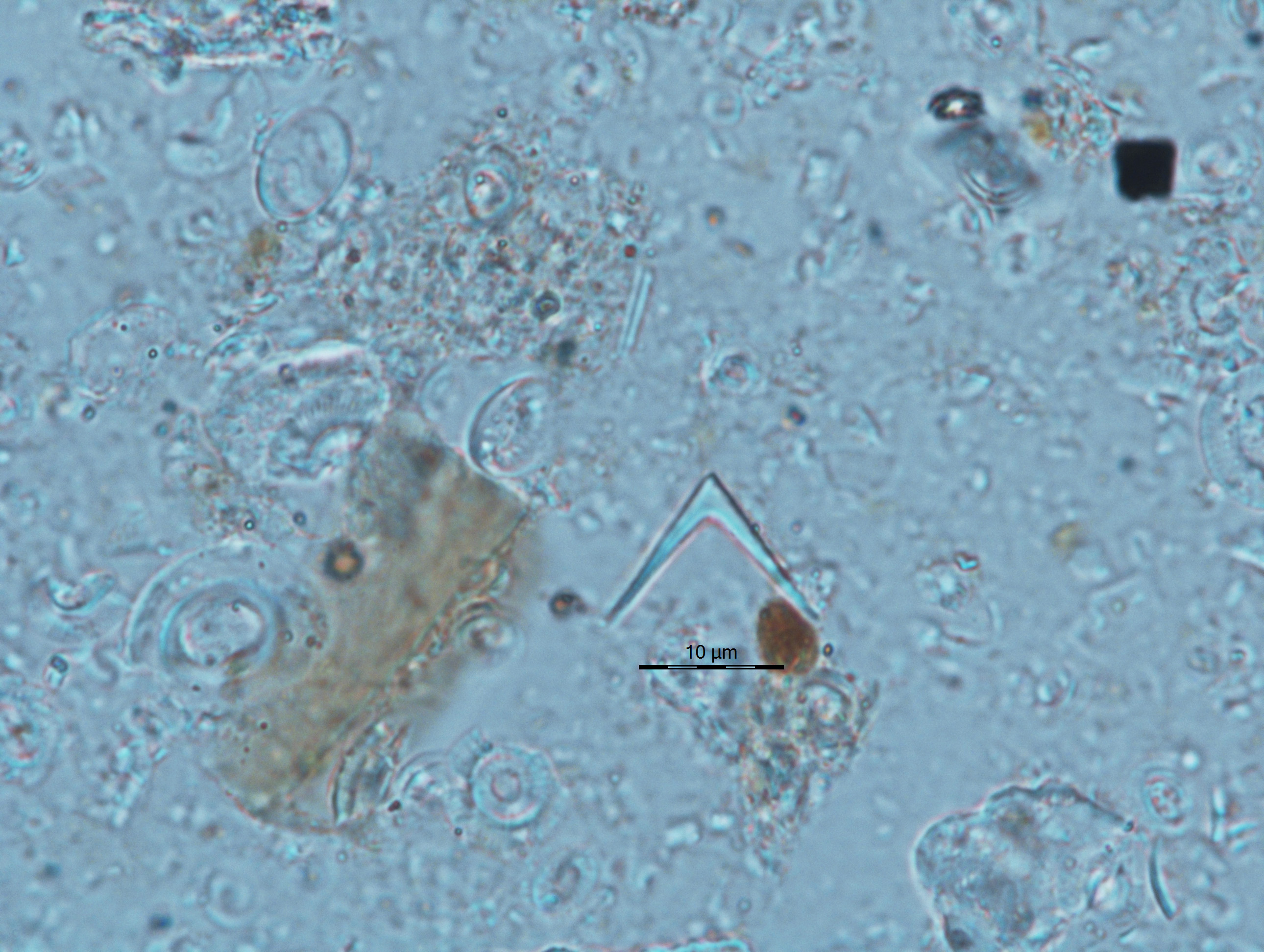 Microscopic View of Sand Grains - Micro-paleontology - The Fossil Forum