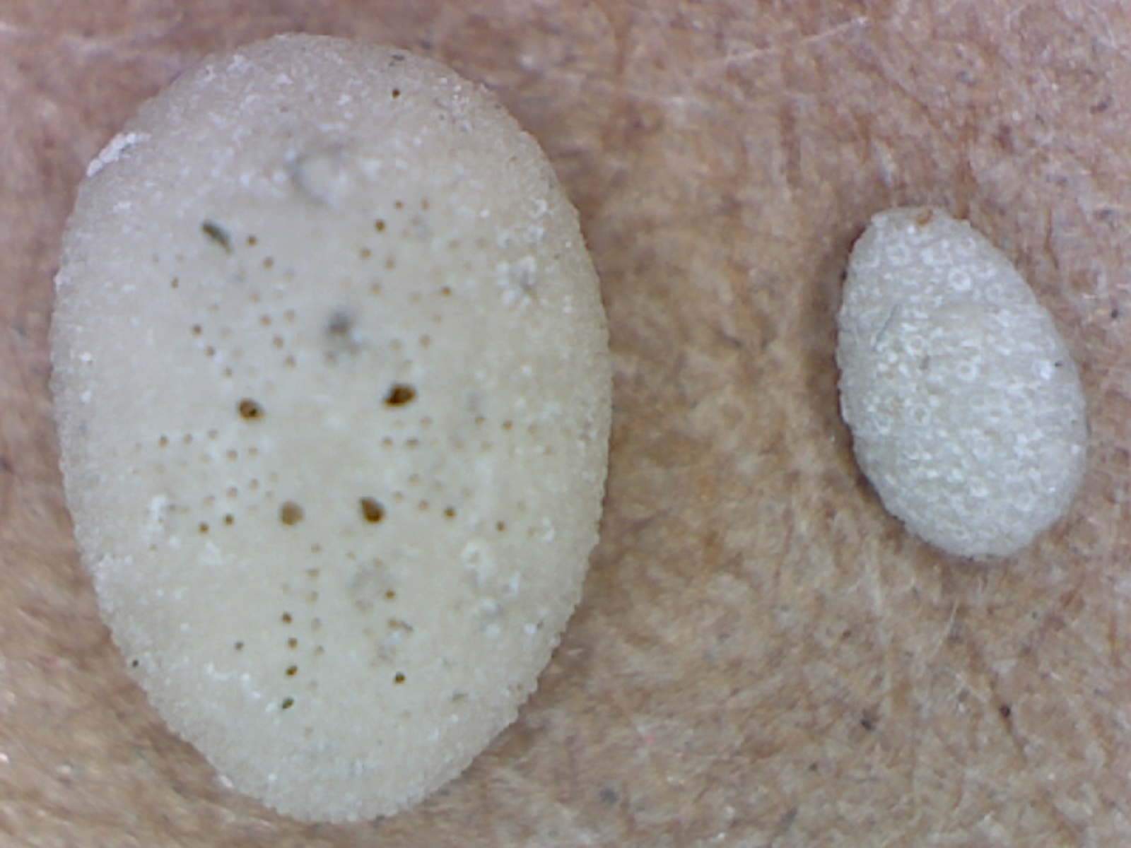 Echinocyamus parvus - Echinoids - The Fossil Forum