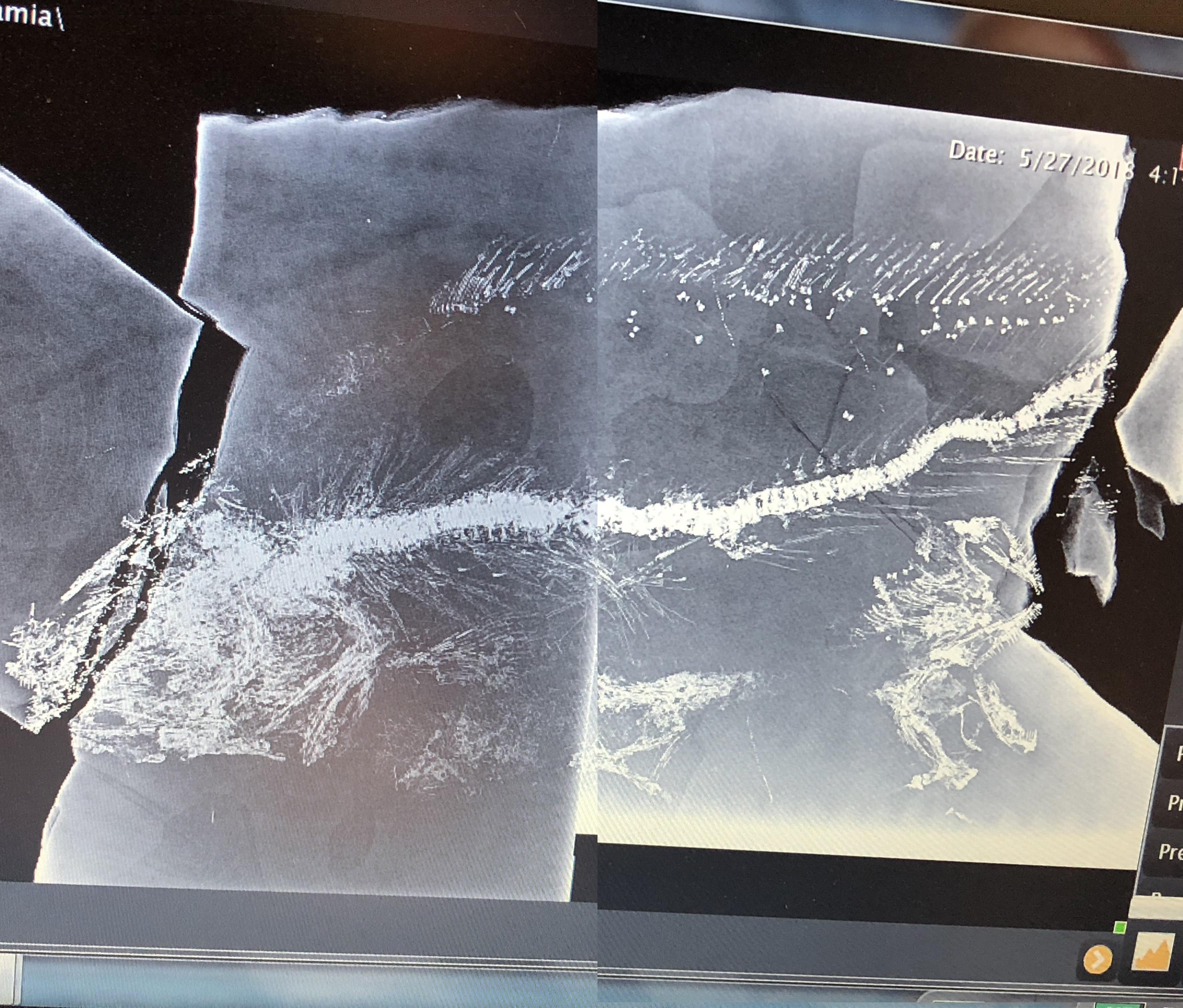 X-ray of Fossil from the Weekend - Fossil Hunting Trips - The Fossil Forum