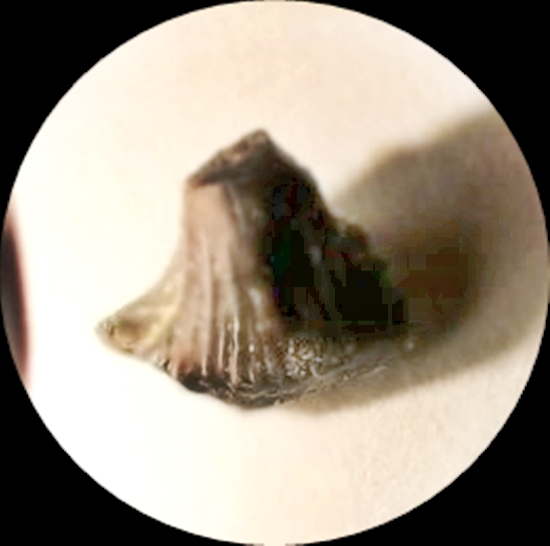Hybodontid shark teeth - Fossil ID - The Fossil Forum