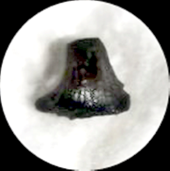 Hybodontid shark teeth - Fossil ID - The Fossil Forum