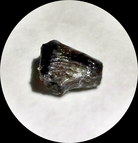 Hybodontid shark teeth - Fossil ID - The Fossil Forum