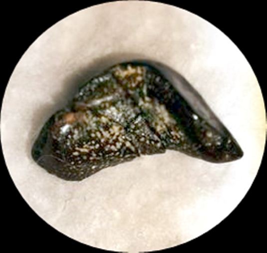Hybodontid shark teeth - Fossil ID - The Fossil Forum