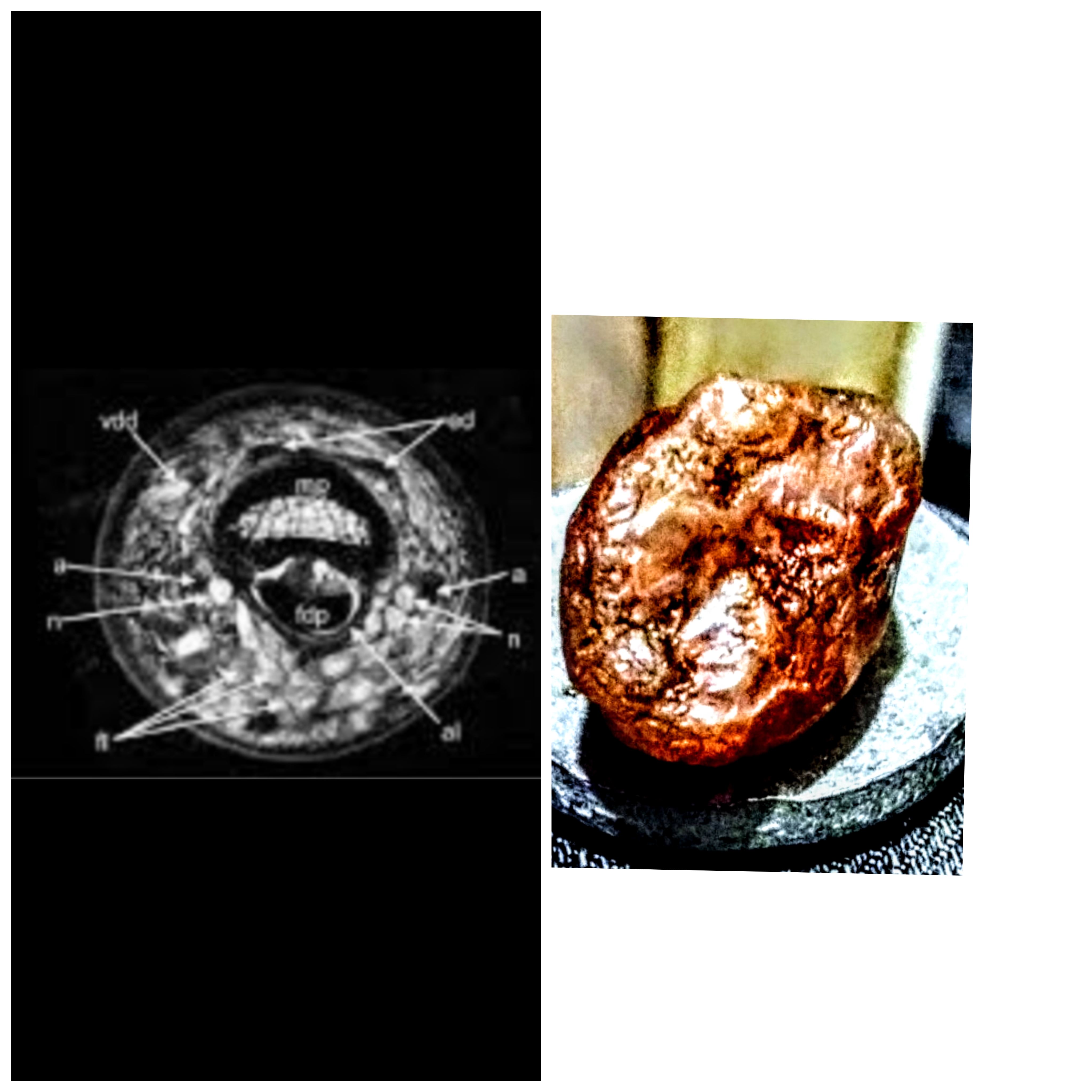 Petrified Fingertip - Fossil ID - The Fossil Forum