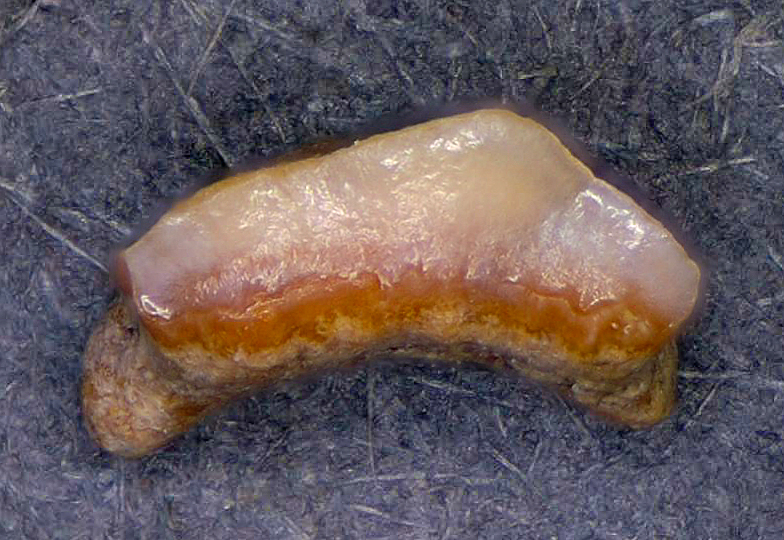 Need help to ID this rare and strange tooth found in the Midra shale ...
