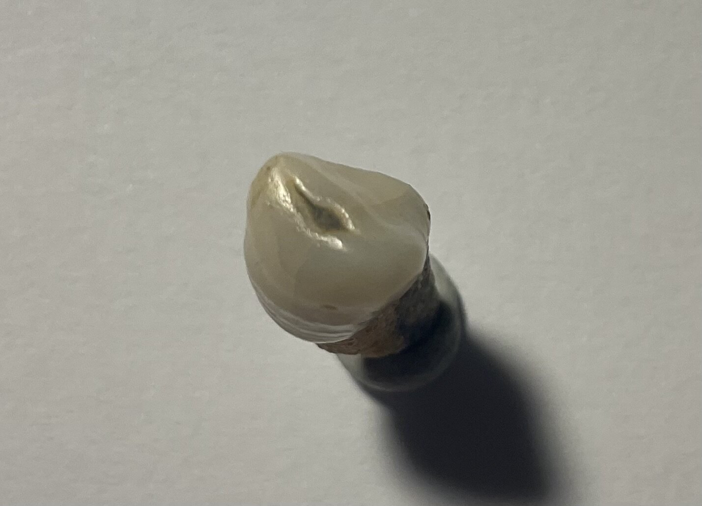 Human tooth ?(!) - Fossil ID - The Fossil Forum
