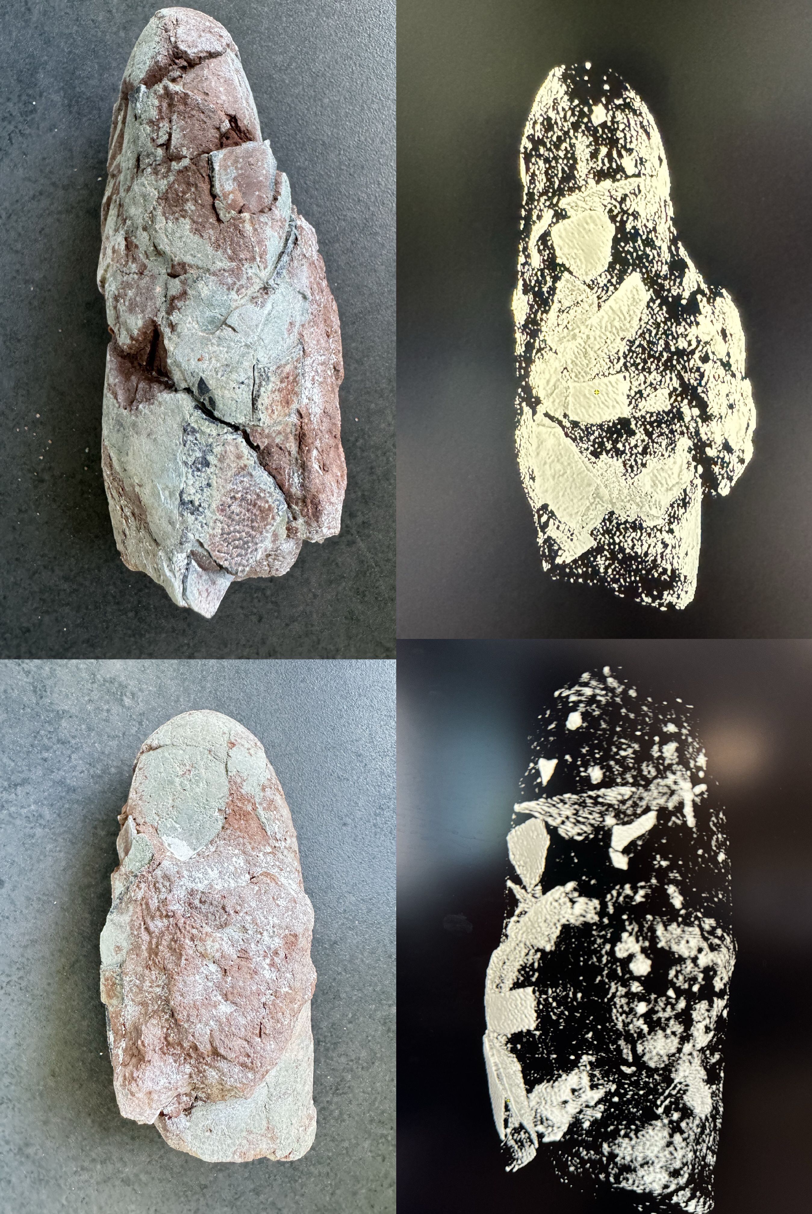 CT scan help to view where eggshell is located, for preparation ...