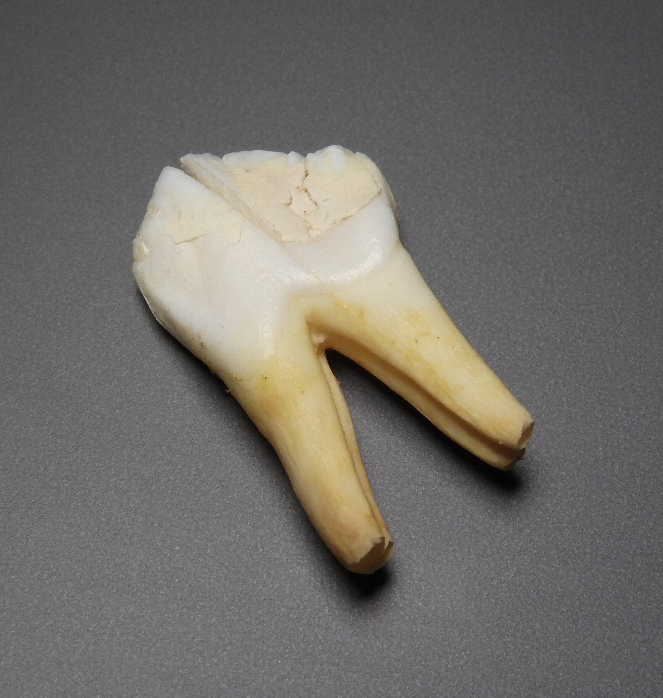 Possible human tooth, maybe ancient? - Fossil ID - The Fossil Forum