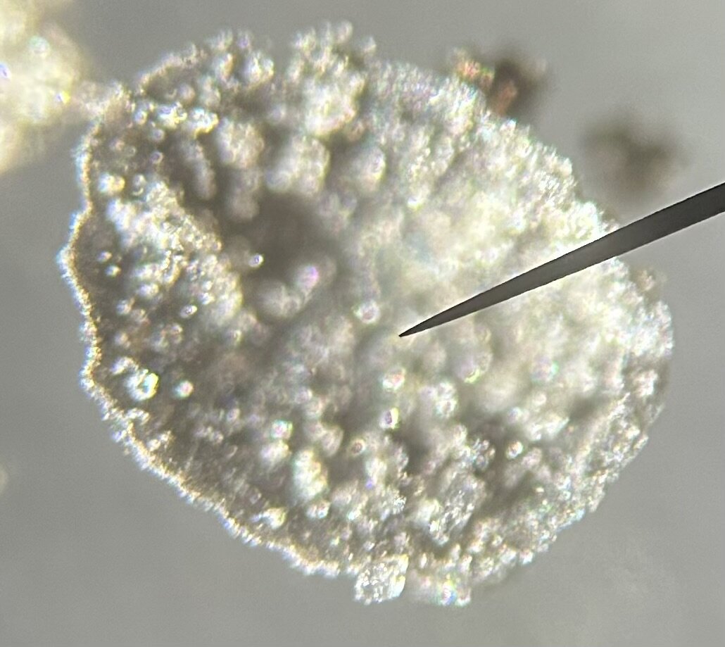 Cambrian microfossils Arkansas - Micro-paleontology - The Fossil Forum