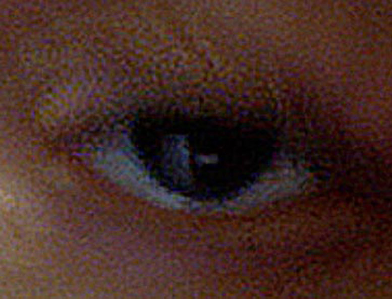 The eyes have it - Macro & Micro Photography - Photo.net