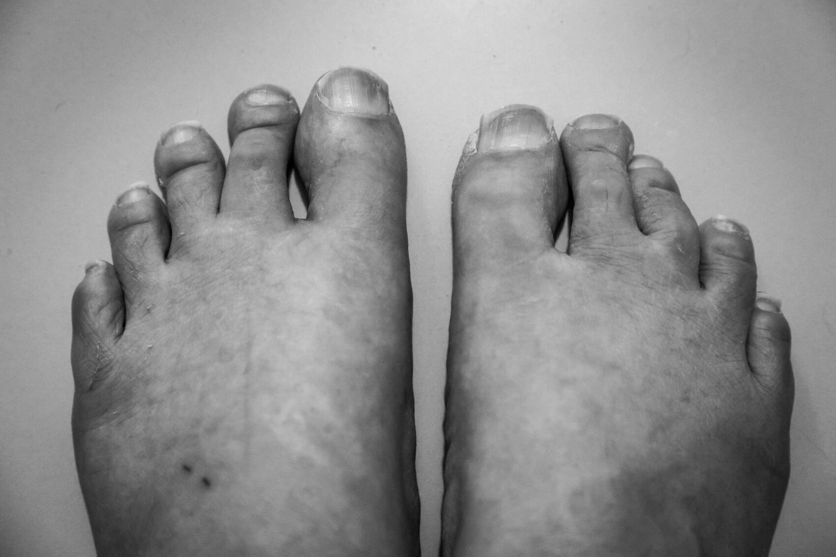 2 Feet - Monochrome - Photo.net