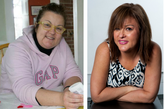 My Bariatric Life - Dr. Catherine Winslow Facial Plastic Surgery ...