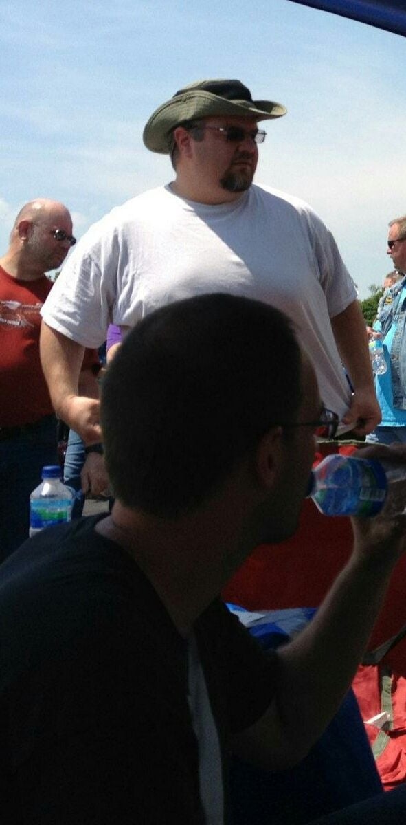 Fat Paul 01 cropped.jpg - Before and After Gastric Sleeve Photos ...