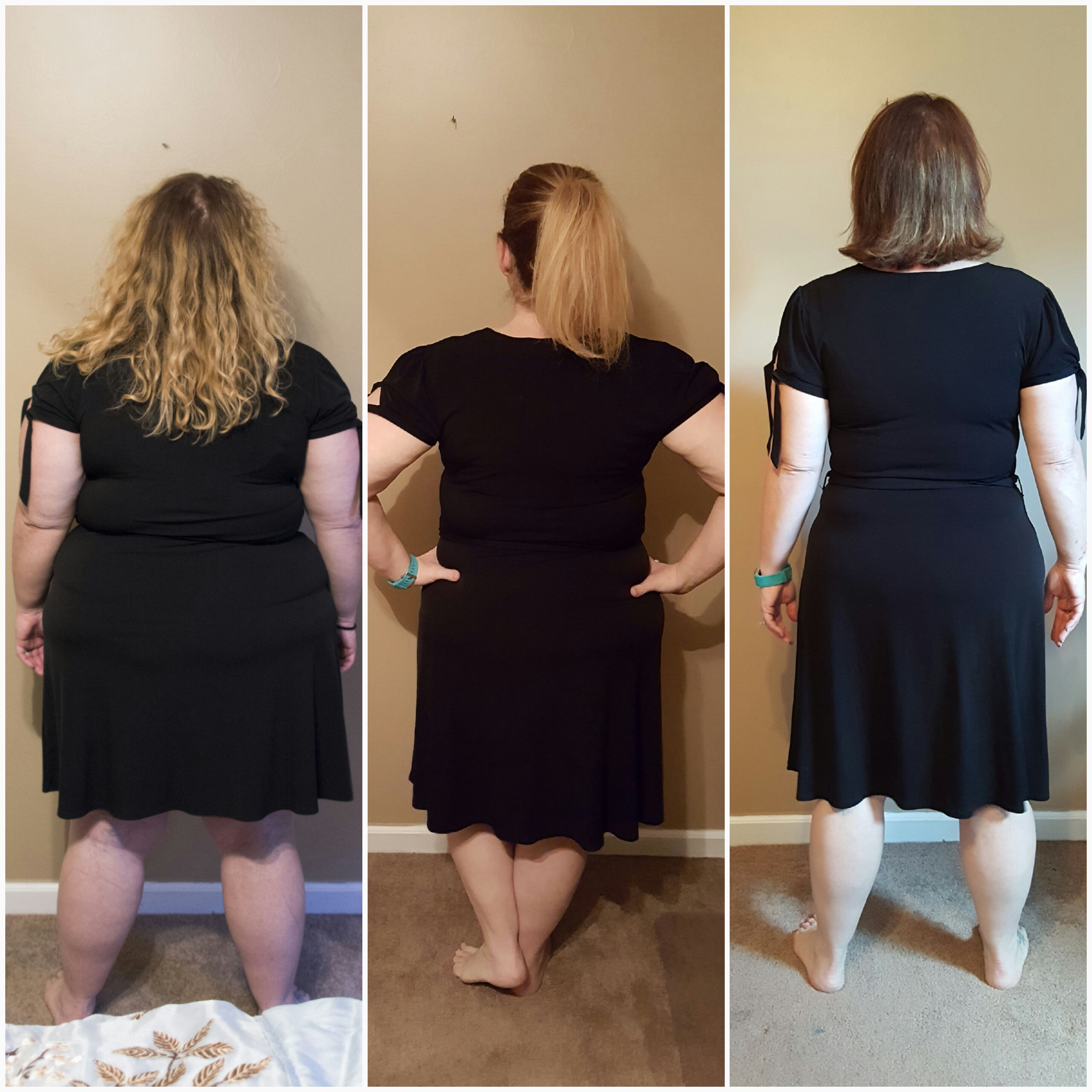 6 months! Before, 3 months & 6 months photos! - Weight Loss Surgery ...