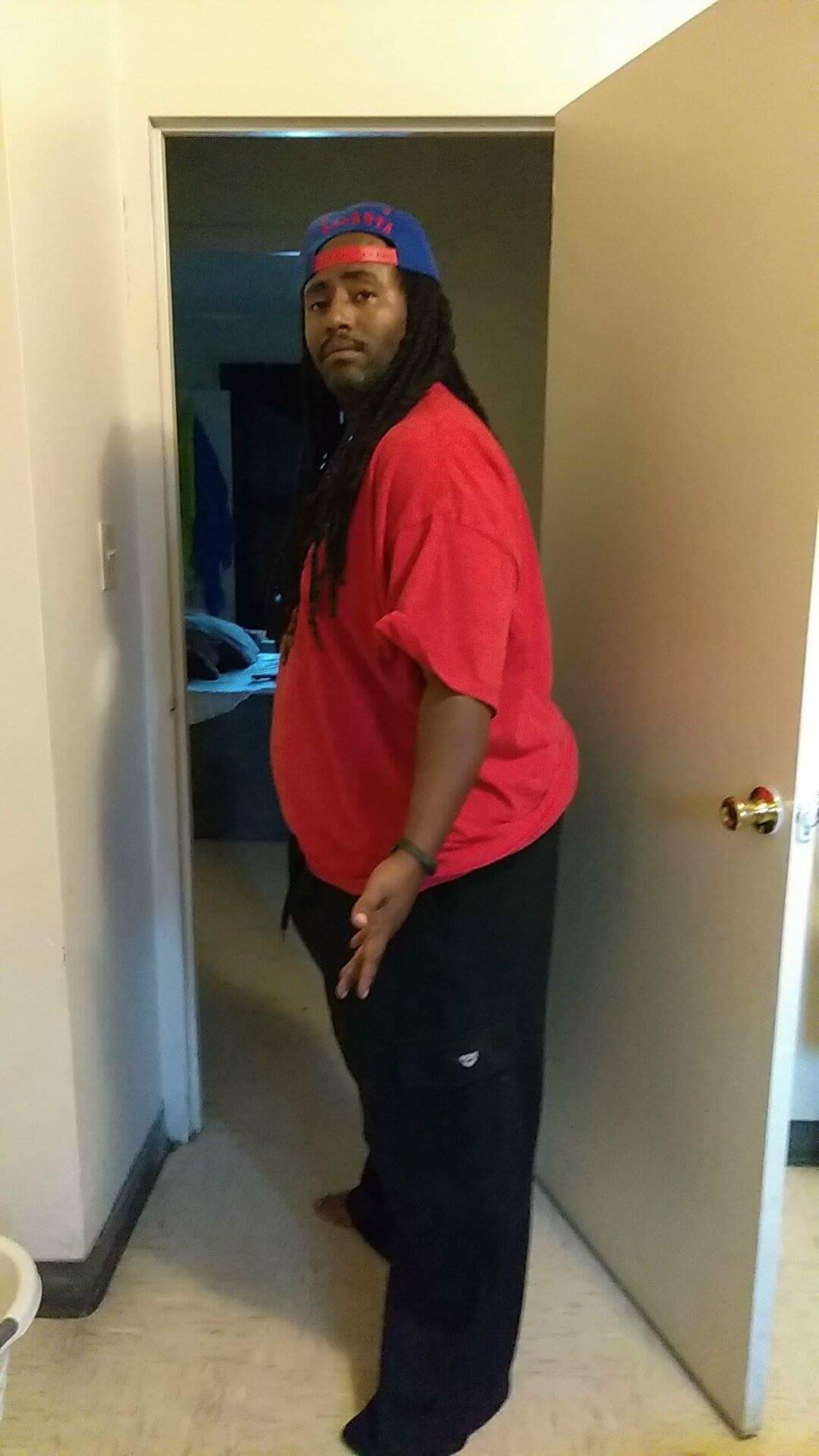 96 pounds down in three months - Weight Loss Surgery Success Stories ...