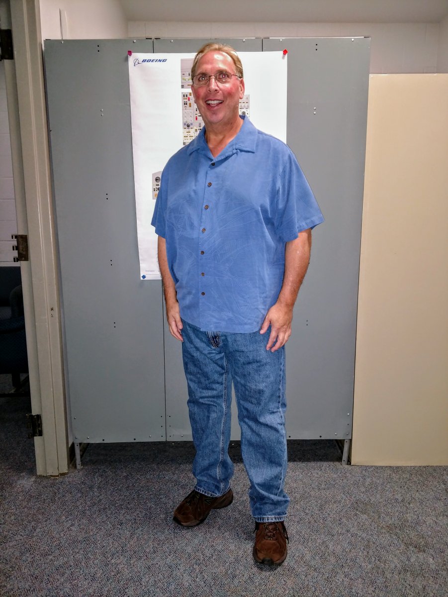 Down 137 Pounds - Before and After Duodenal Switch Photos - BariatricPal