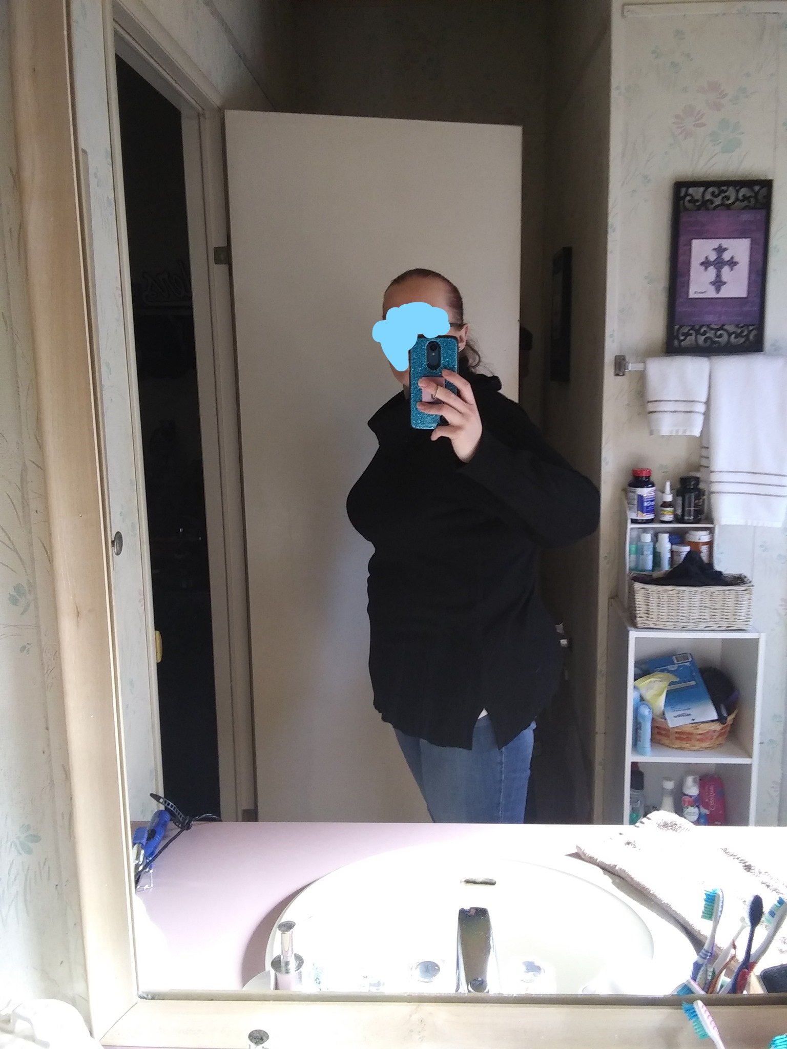 SIPS procedure coming up - PRE-Operation Weight Loss Surgery Q&A ...