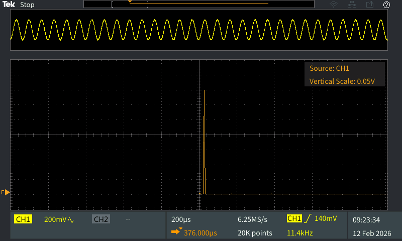 Single sided deaf (1 typical ear and 1 CI) early adjustment - Single ...