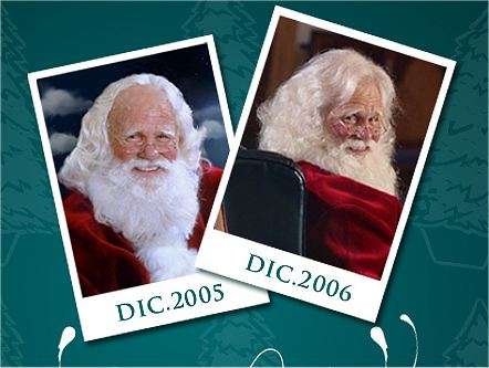 Santa's Before and After Photos - Hair Transplant Reviews - Hair ...