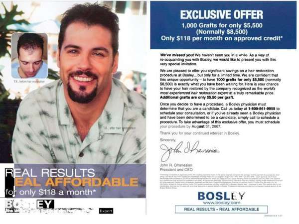 Bosley or MHR - Hair Restoration Questions and Answers - Hair ...