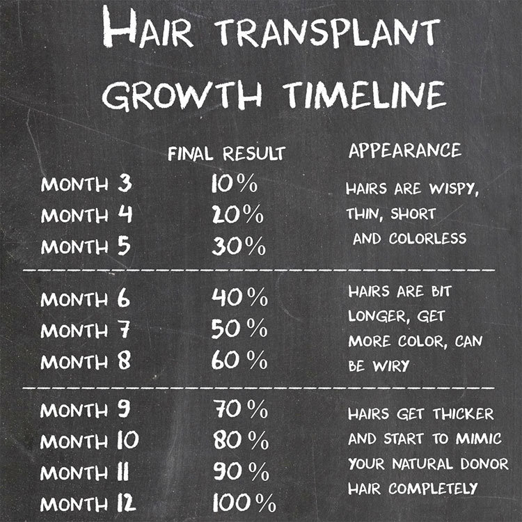 Growth chart - Hair Restoration Questions and Answers - Hair ...