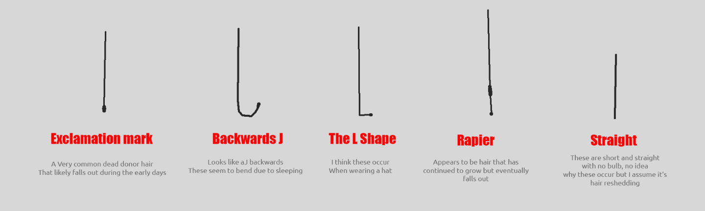 Examples of shedded hair shapes post hair transplant operation - Hair ...