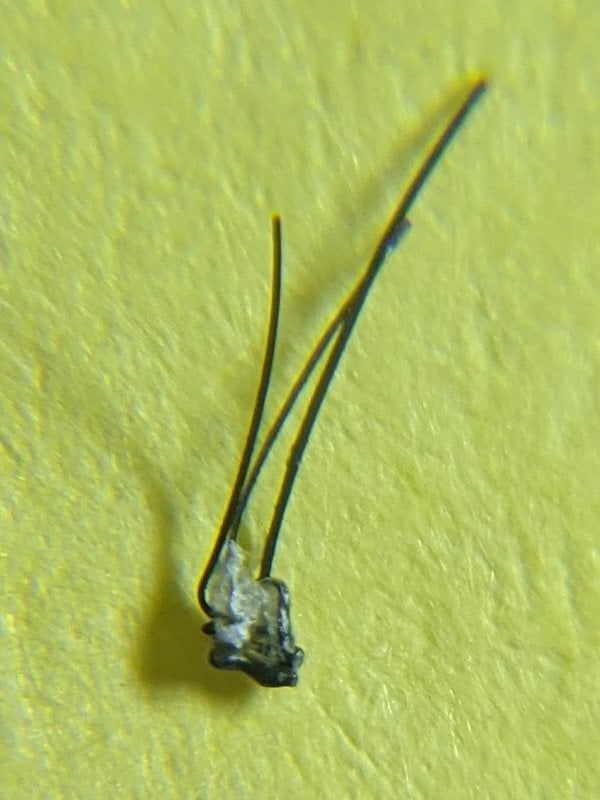 How can you tell if a graft is dislodged? - Hair Restoration Questions ...