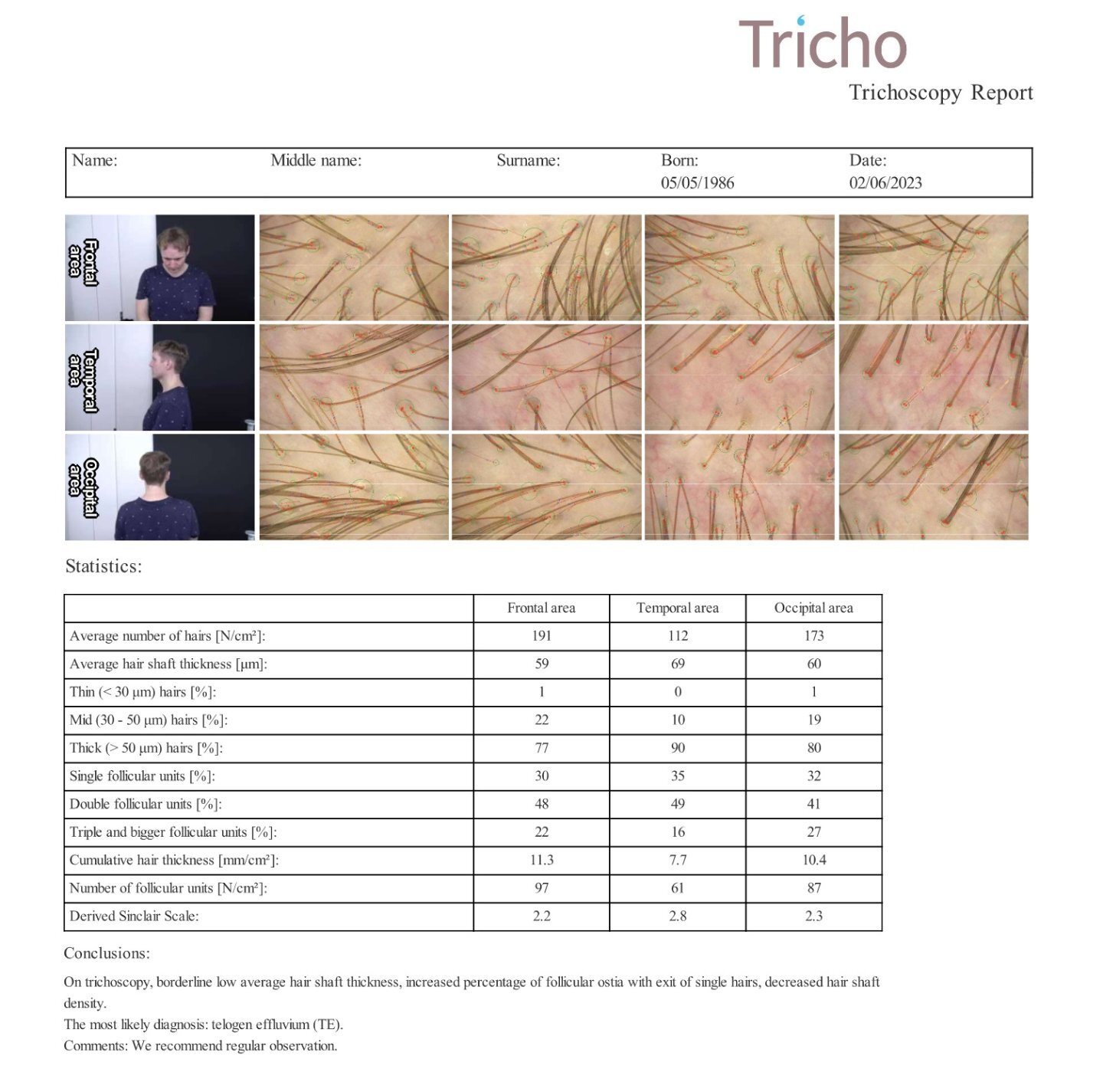 Trichoscopy Results – HELP! - Hair Restoration Questions and Answers ...
