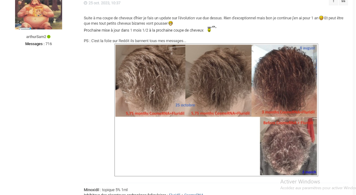 Ban request for user Arthursam - Open Hair Loss Topics - Hair ...