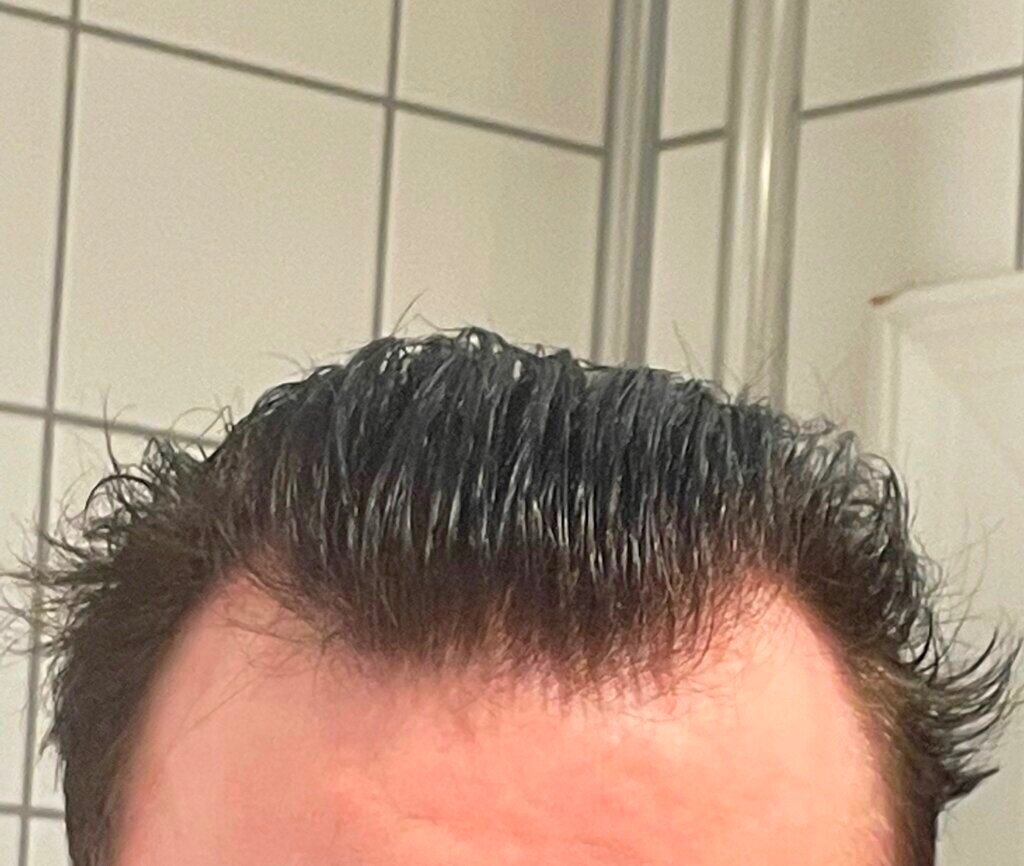 Spray/concealer that gives the impression of a hairline? - Shampoos ...