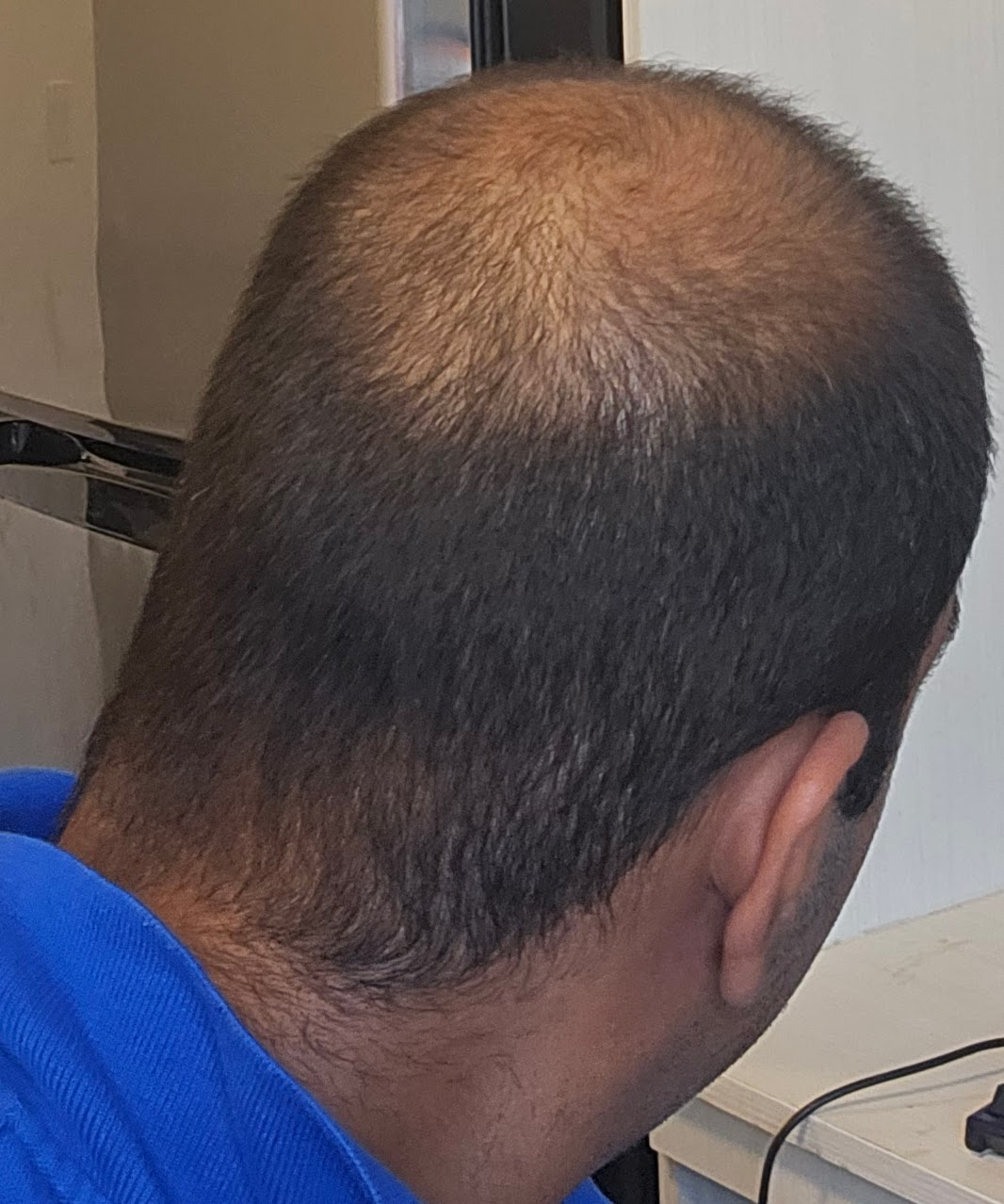 Need advice - Suggest plan and which doctor to consult with (NW5/6 ...