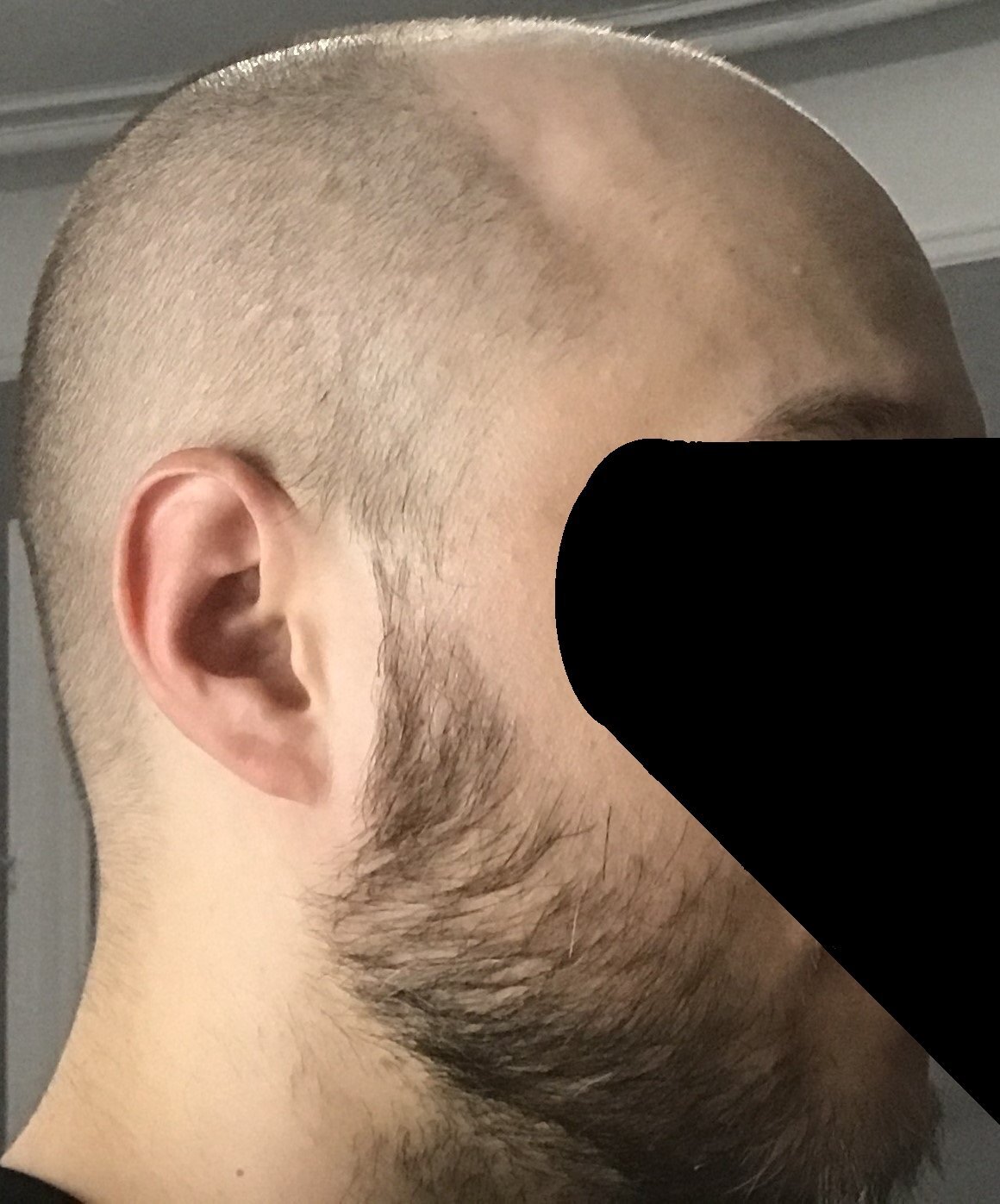 Is it possible to create a buzzcut look (0-1 guard) without SMP? - Hair ...