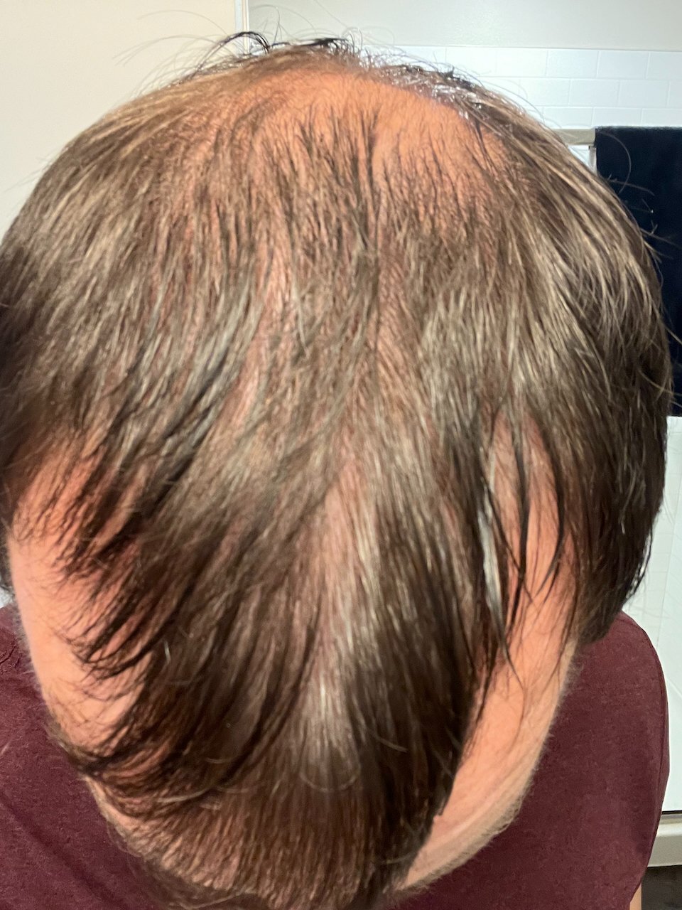 33M / NW4 (US based): Seeking advice and doc recommendations for first ...