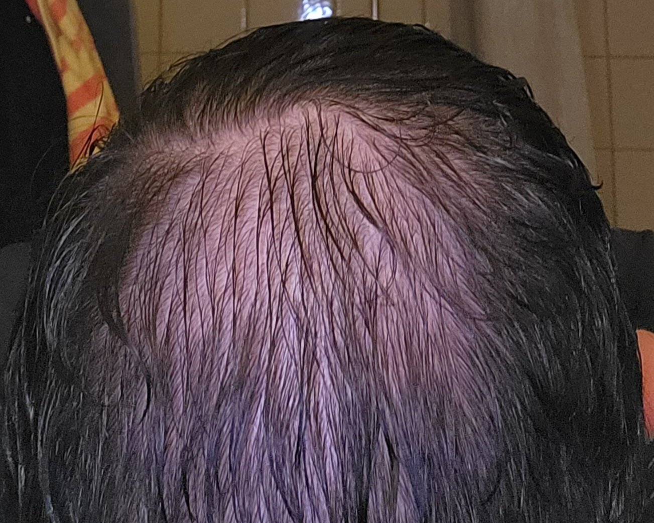 Getting very worried about results after reading Surgery Rapport from ...