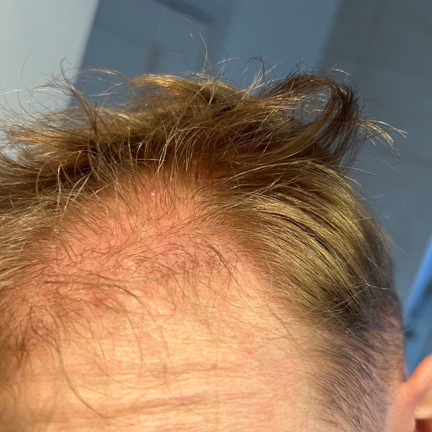 Is not having much growth at the 6 month mark a sing of a bad result ...