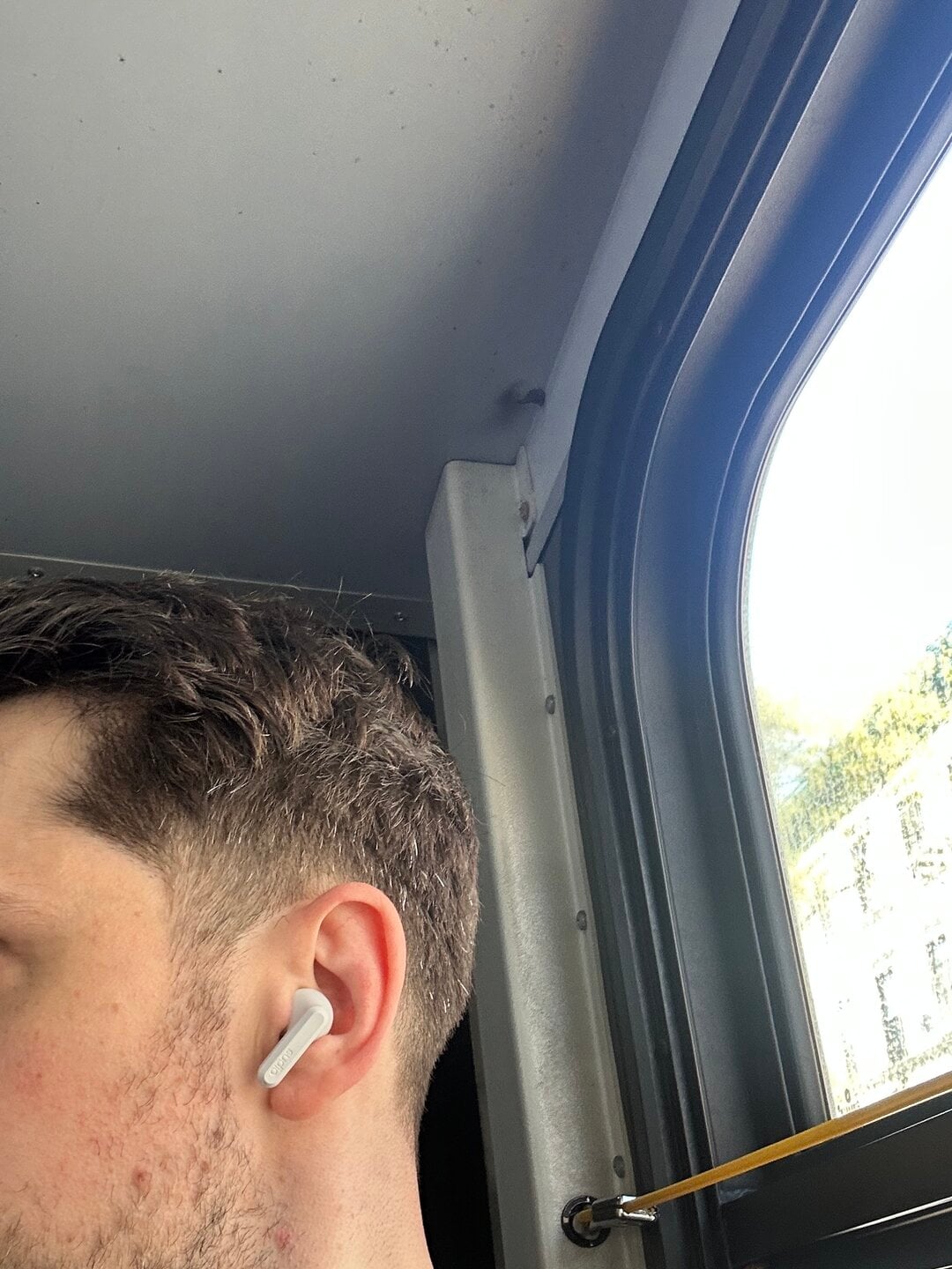 Dr. Blake Bloxham left me with a bad hairline, seeking advice on next ...