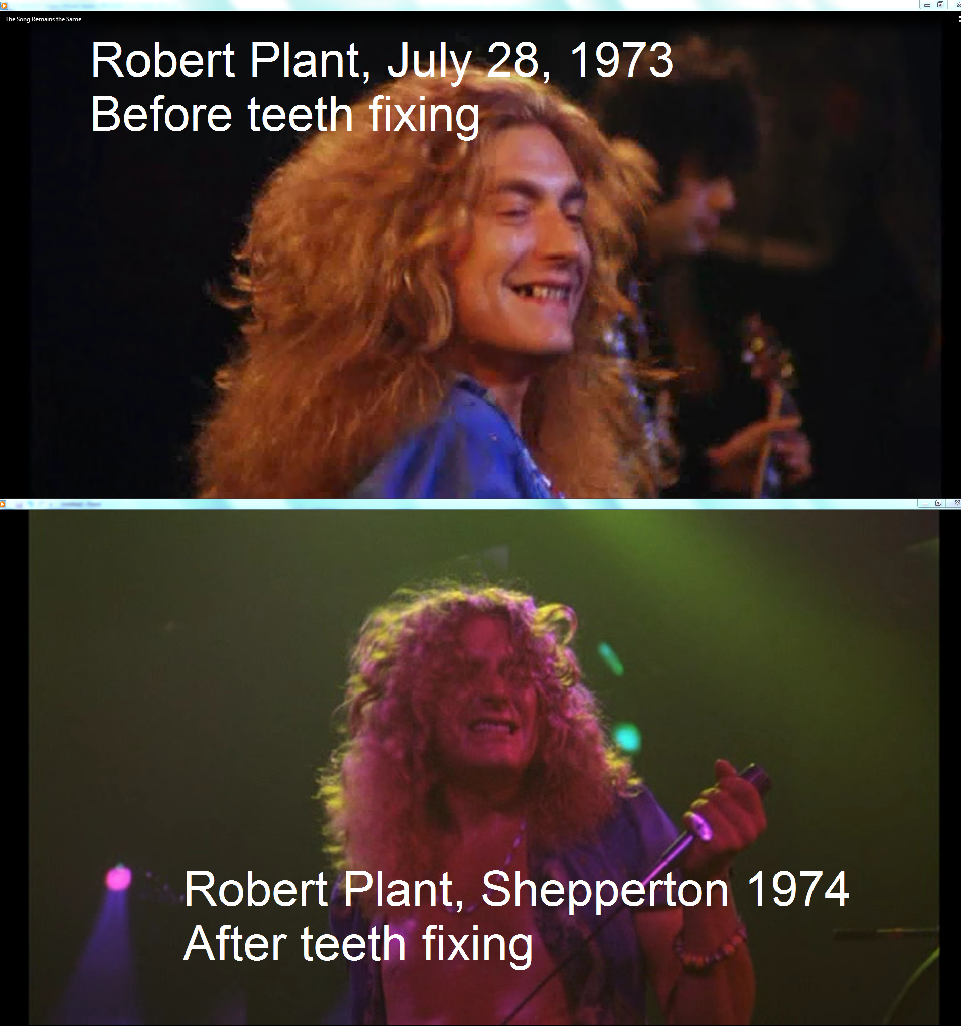 Photos of Robert's teeth before he had them fixed? - Photos - Led ...