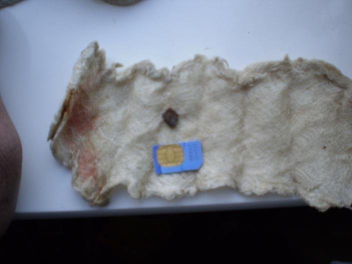 Shrapnel wounds - Other Great War Chat - The Great War (1914-1918) Forum
