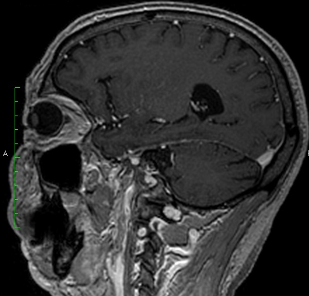 Choosing the Best Medical Imaging Scan to Create a 3D Printed Medical ...