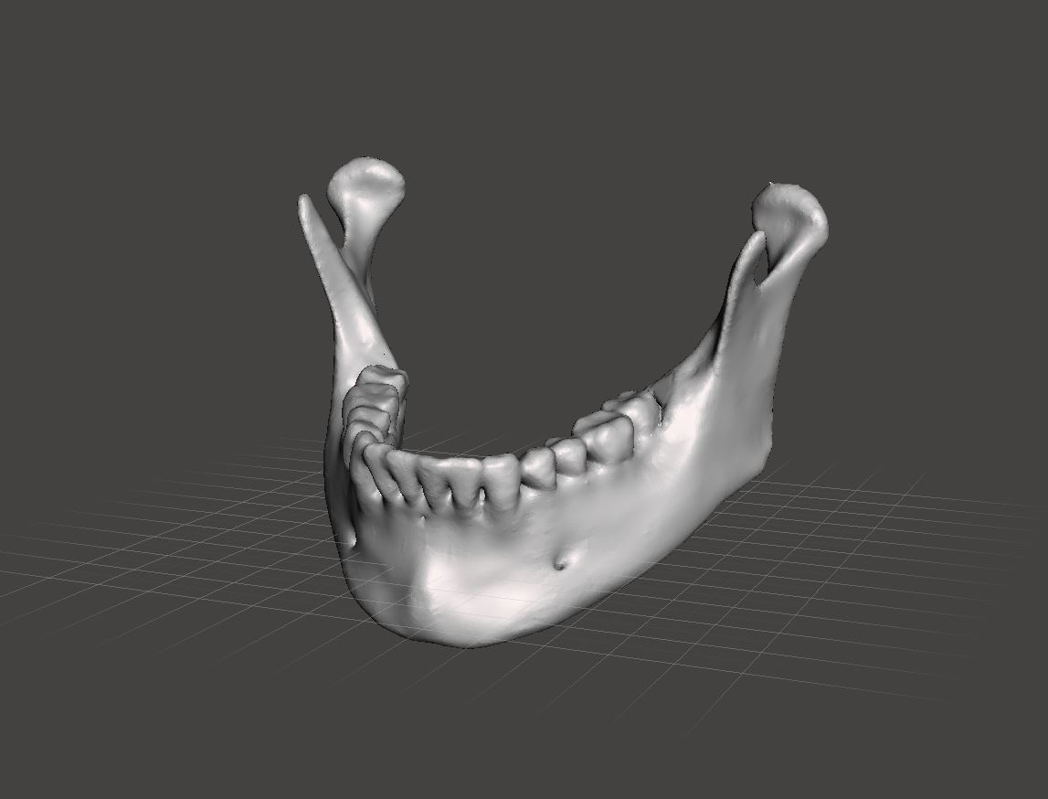 Mandibola - Dental, Orthodontic, Maxillofacial - embodi3D.com