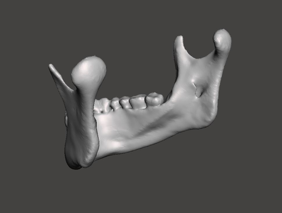 Mandibola - Dental, Orthodontic, Maxillofacial - embodi3D.com