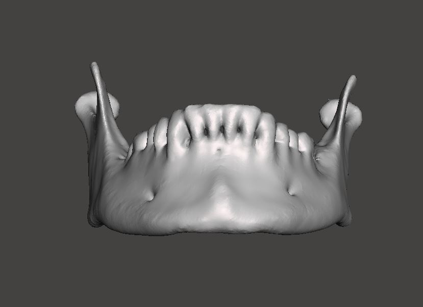 Mandibola - Dental, Orthodontic, Maxillofacial - embodi3D.com
