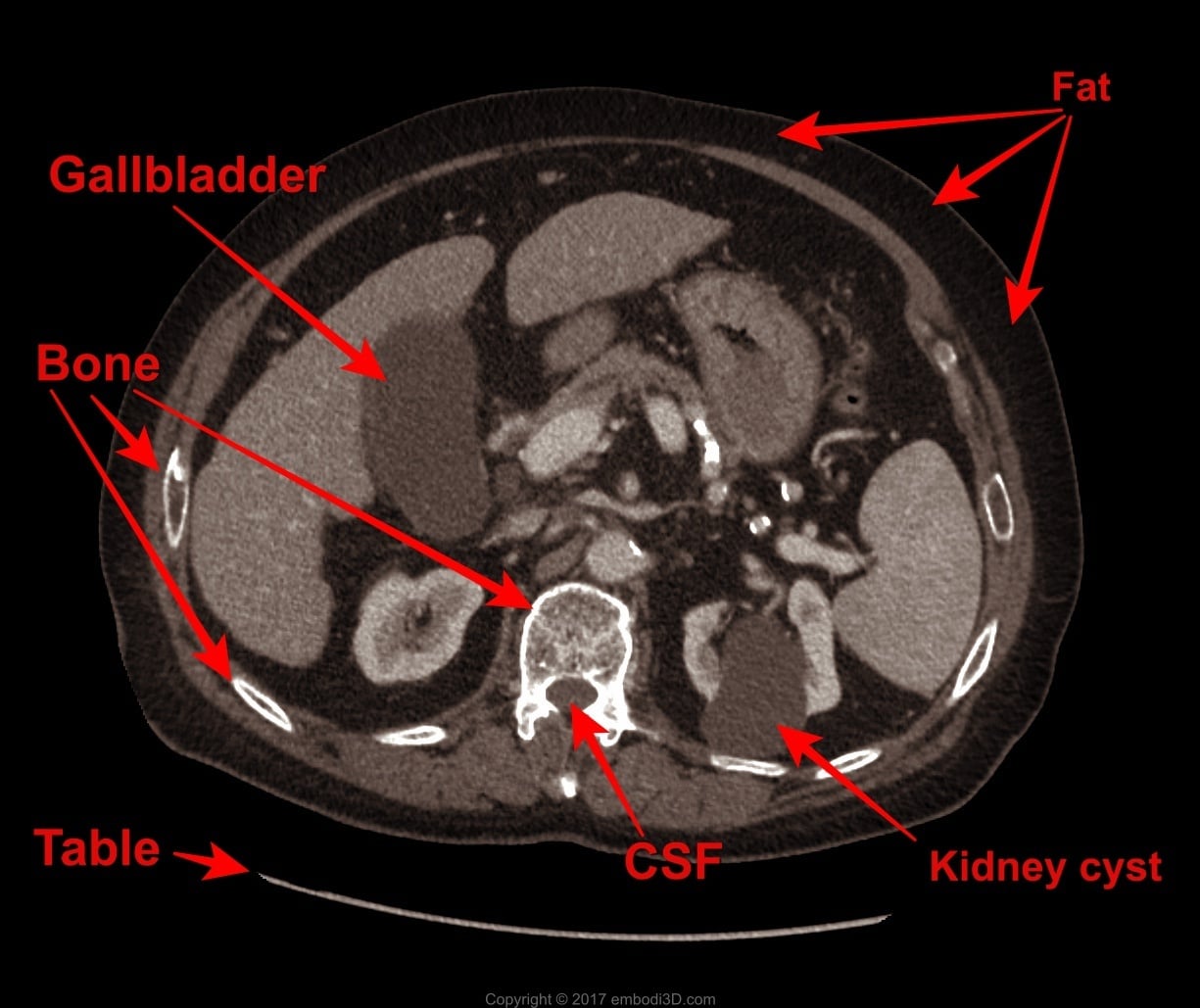 How to Easily Tell the Difference Between MRI and CT Scan - 3D Printing ...