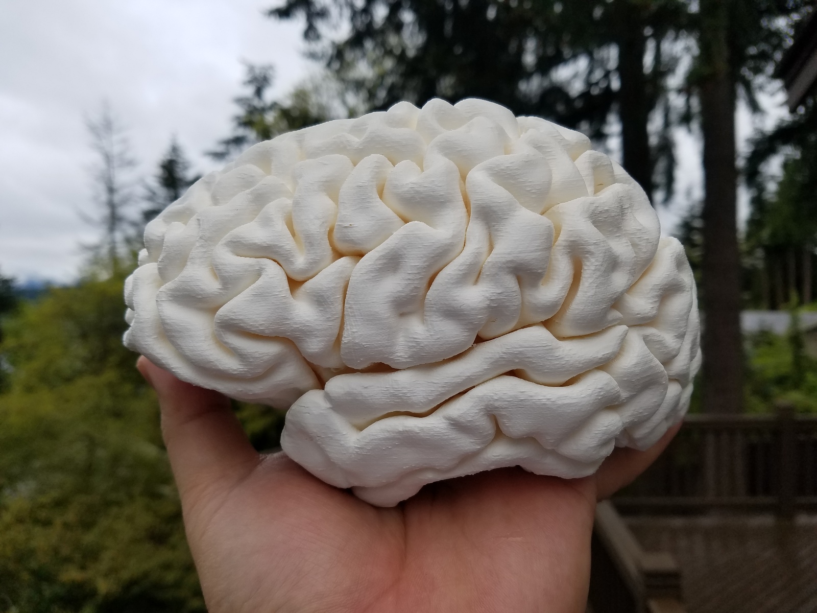 3D printed brain from MRI - 3D Printable Models - embodi3D.com